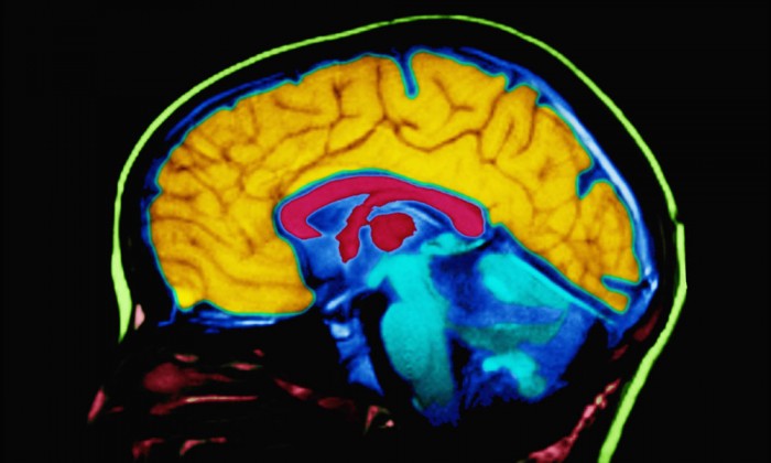 Brain Scans of Hoarders Reveal Why They Never De-Clutter | 6-12