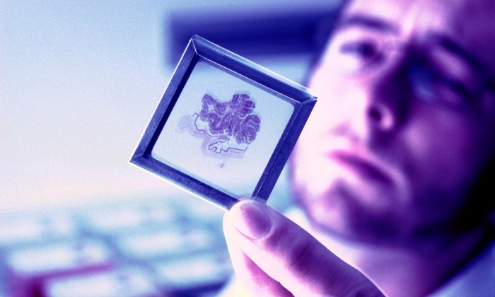 Microbes at Work | 6-12